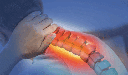 Medial Collateral Ligament (MCL) Rehab Exercises | Detailed Protocol